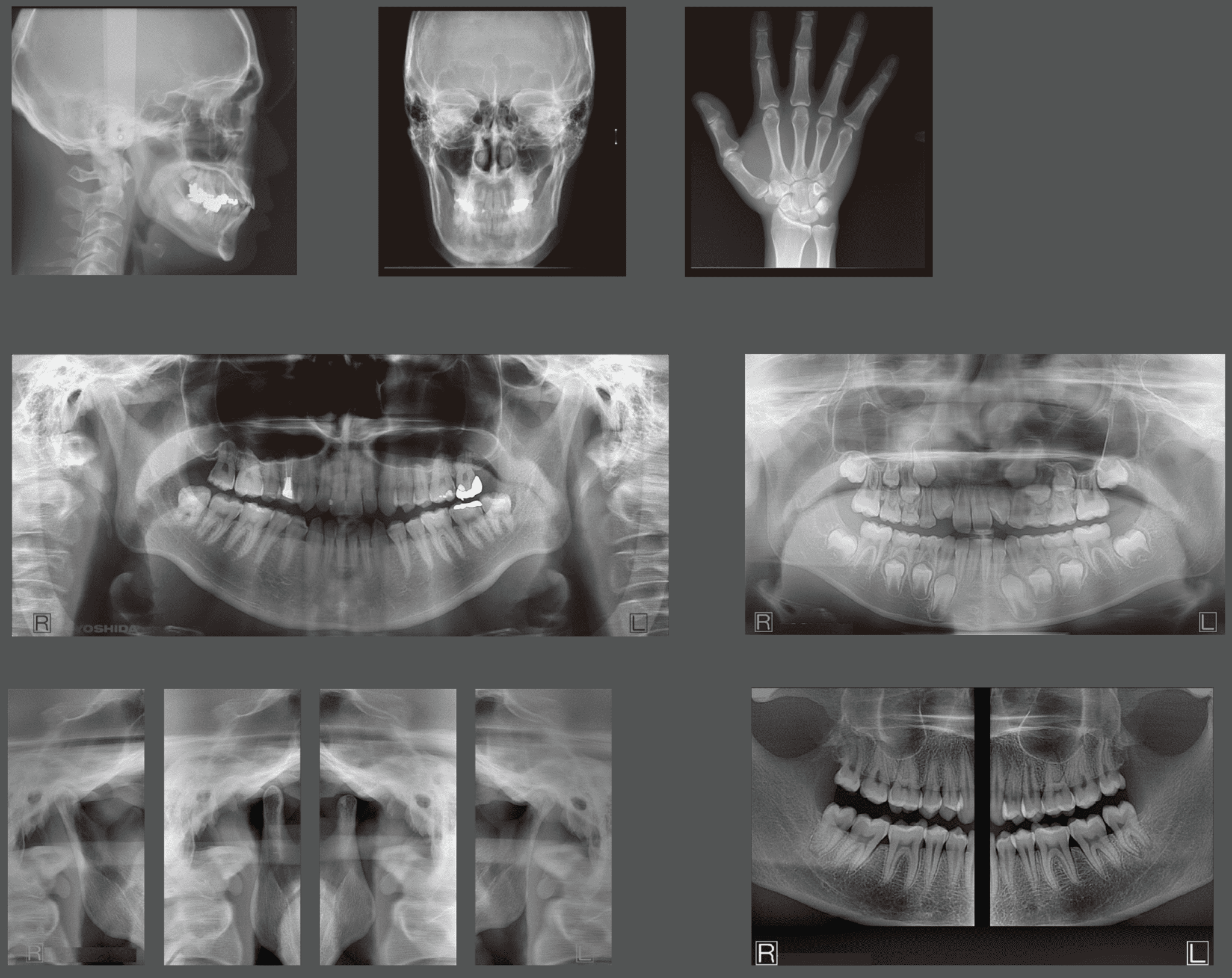 ImageWorks Dental CBCT and Panoramic X-Ray System - Radiology Imaging ...