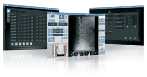 Del Medical Apollo DRF 4.0 Advanced Remote Controlled R/F System ...