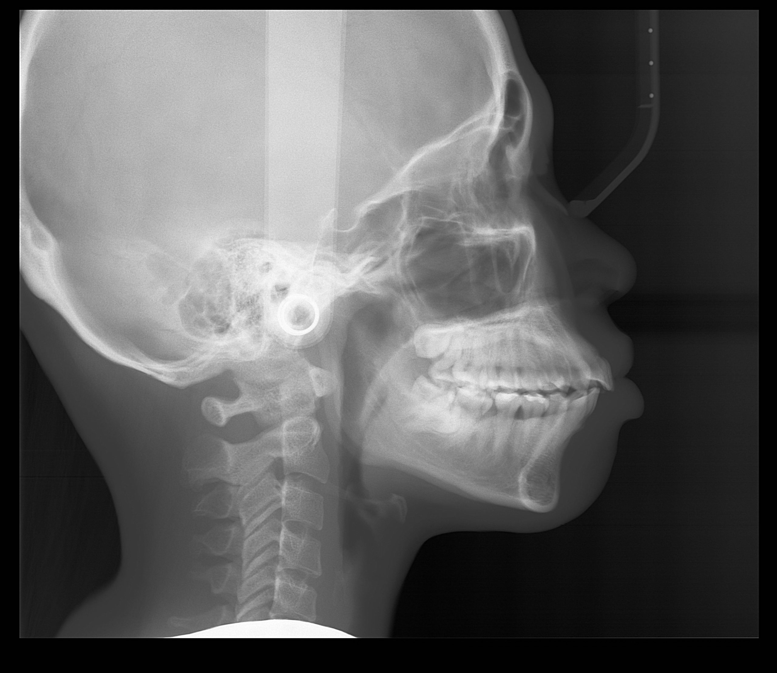 ImageWorks Dental CBCT and Panoramic X-Ray System - Radiology Imaging ...