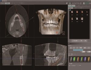 Dental - Radiology Imaging Solutions