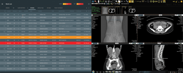 PACS - Radiology Imaging Solutions
