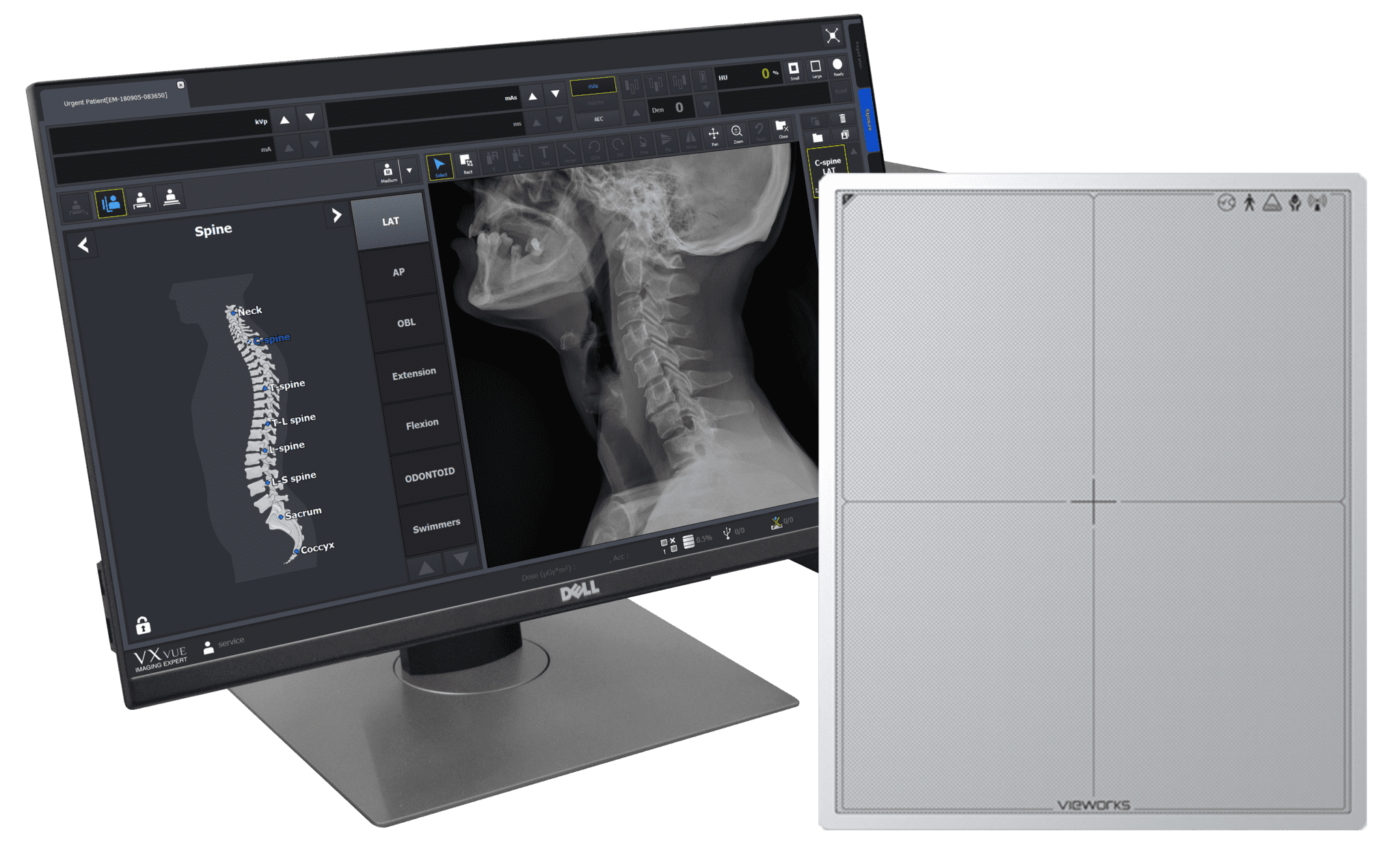 VieWorks DR Panels - Radiology Imaging Solutions