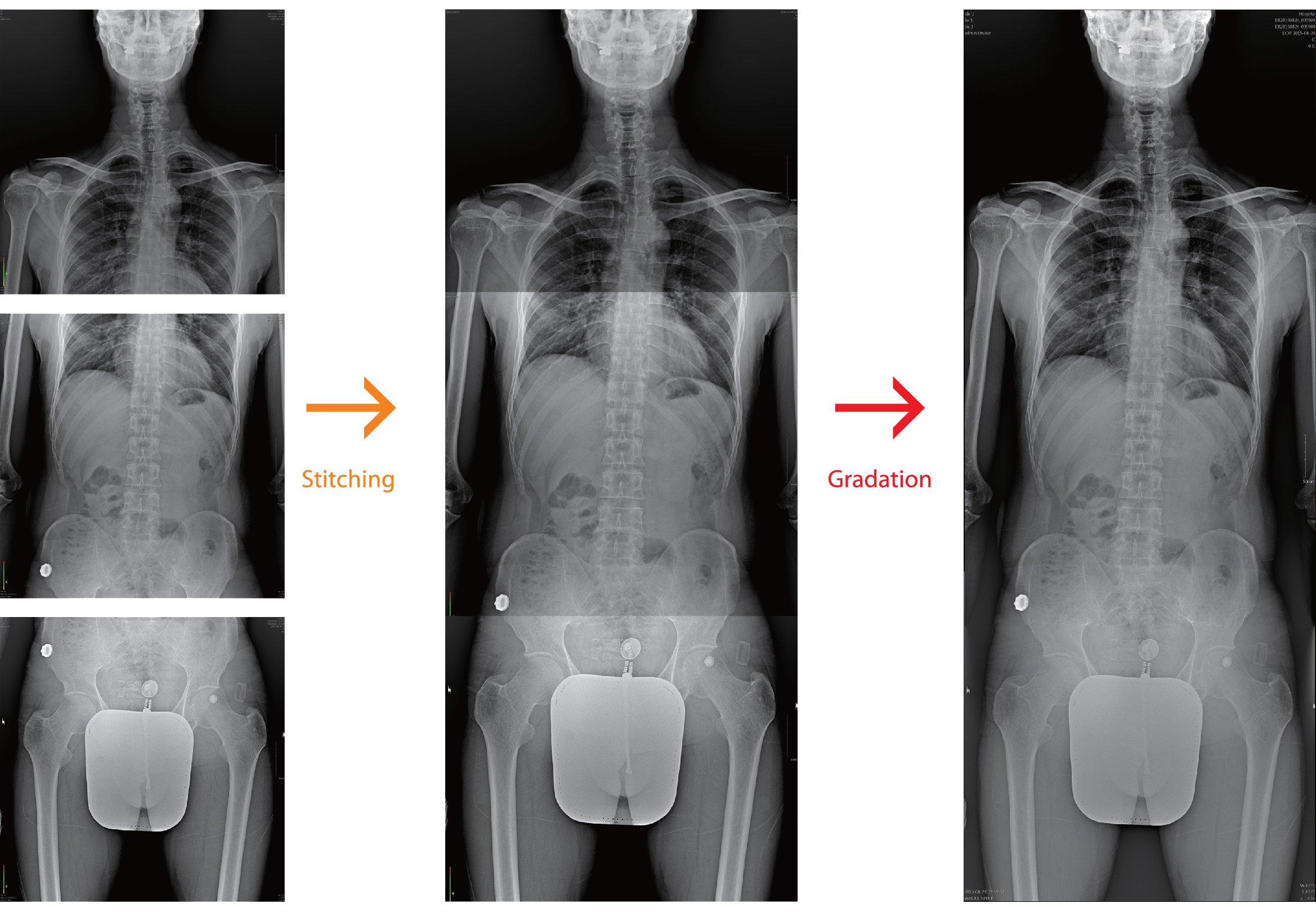 Rayence's 1417WCC 14x17in Wireless Flat Panel DR Detector - Radiology ...