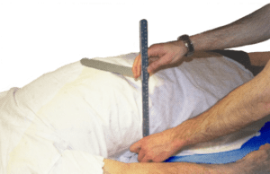 Aluminum Bariatric Body Caliper - Radiology Imaging Solutions