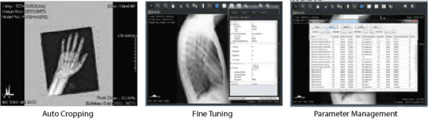 VieWorks VXvue DR Acquisition Workstation - Radiology Imaging Solutions